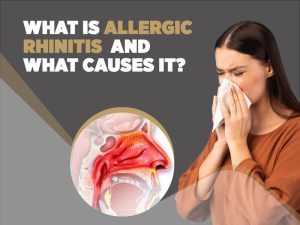 Treating Allergic Rhinitis From Seasonal Allergies - King's Pharmacy ...